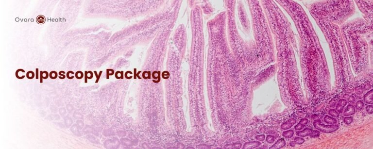 Private Colposcopy Package in London | Ovara Health