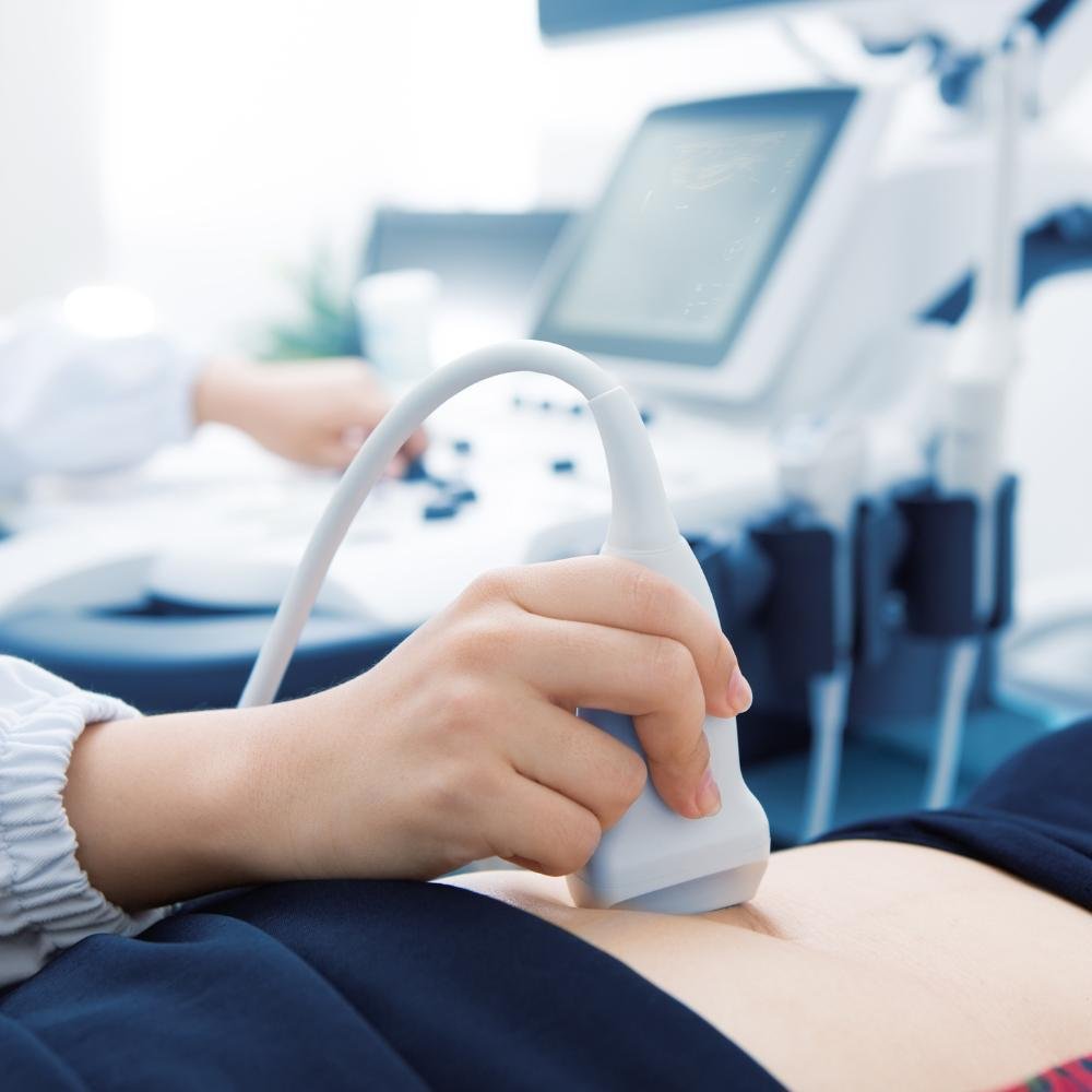 Ultrasound Scan - Ovara Health